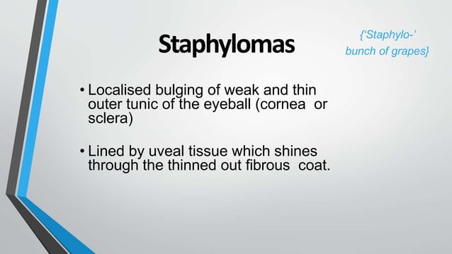 Diseases of sclera | PPTX | Eye and Vision Conditions | Diseases and ...