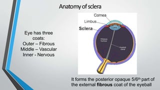 Diseases of sclera | PPTX