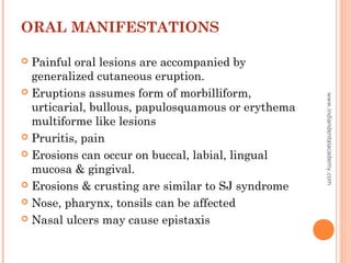 Diseases of skin 2/ oral surgery courses | PPT