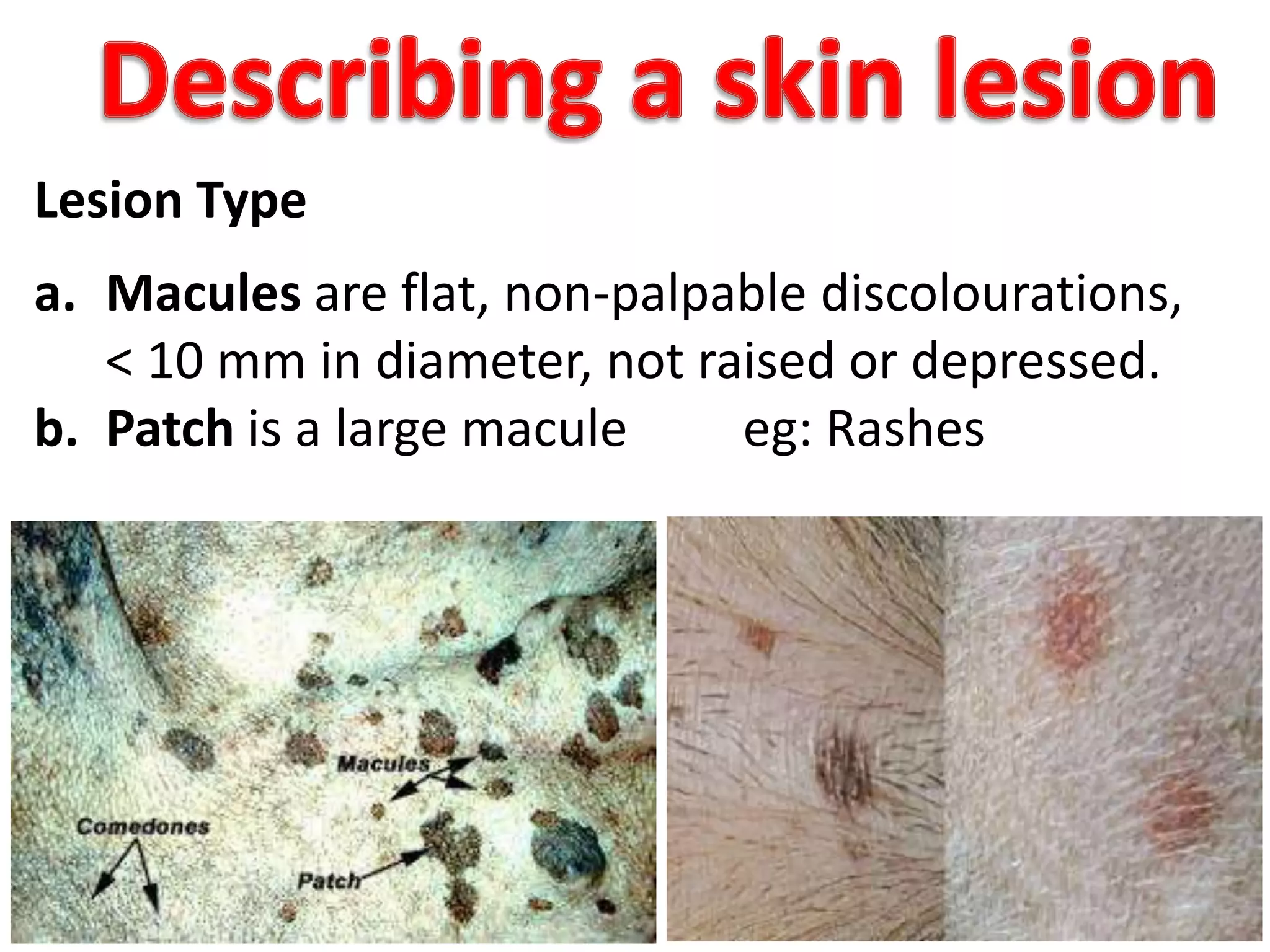 Diseases of skin - Veterinary Dermatology | PPTX