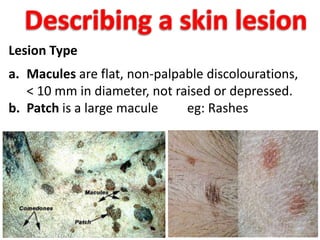 Diseases of skin - Veterinary Dermatology | PPTX
