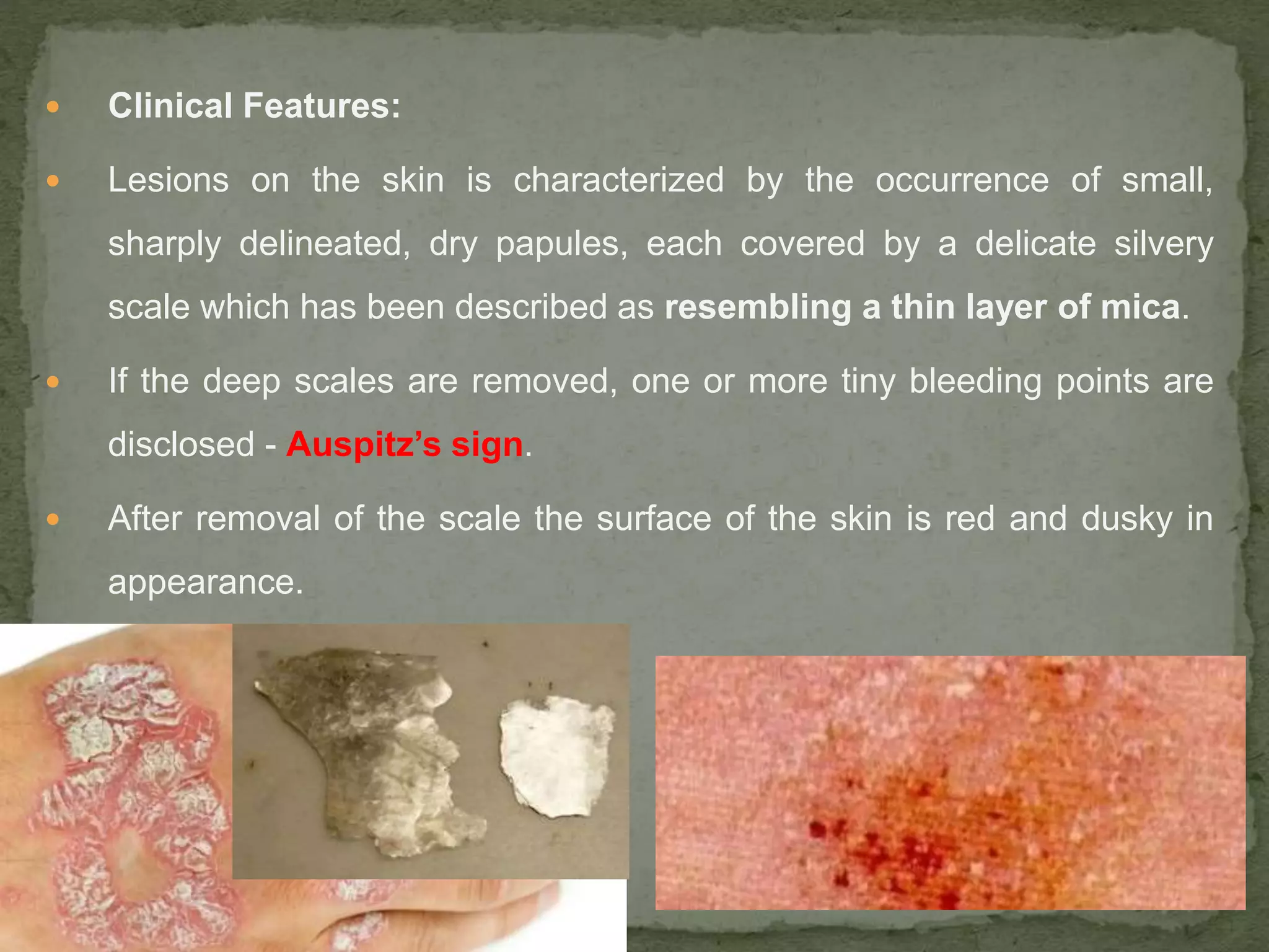 Diseases of skin | PPTX