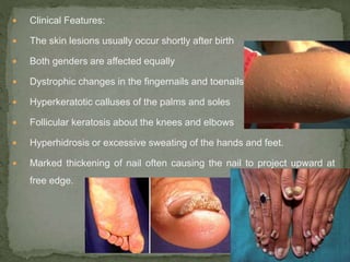 Diseases of skin | PPTX