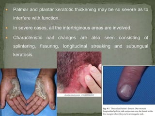 Diseases of skin | PPTX