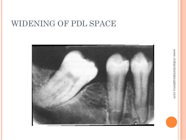 Diseases of skin 6 / dental implant courses by Indian dental academy
