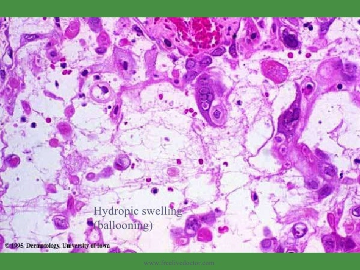 Diseases of skin.... more