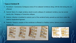 Clinical study of Diseases of spine.pptx