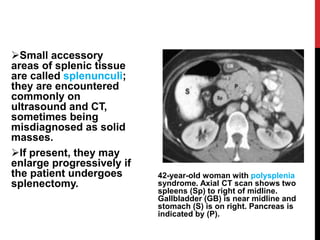 Diseases of spleen | PPTX