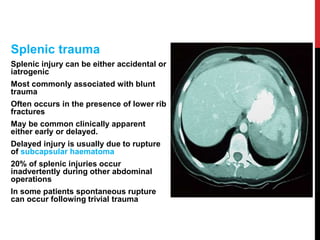 Diseases of spleen | PPTX