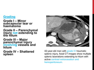 Diseases of spleen | PPTX