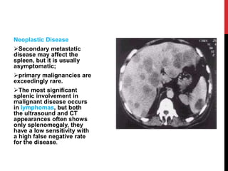 Disorders Of The Spleen