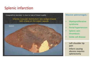 Diseases of Spleen, treatment with surgical treatment | PPT