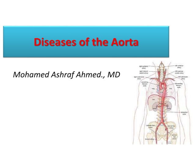 Diseases of the aorta | PPTX | Heart and Cardiovascular Diseases | Diseases and Conditions