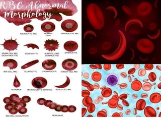 Diseases of the Blood in children.ppt