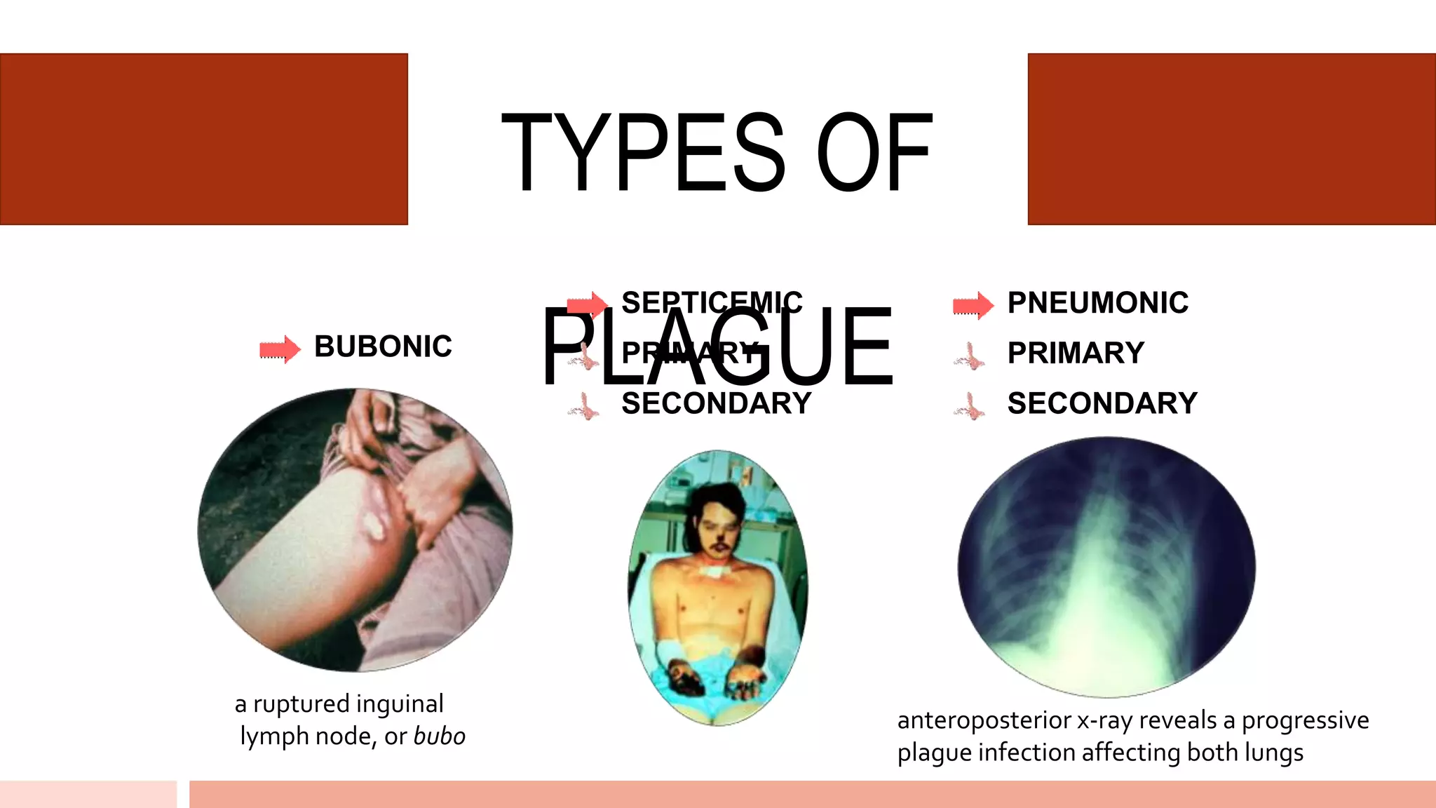 Diseases of the Circulatory System | PPTX