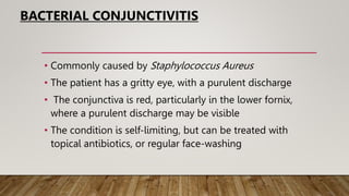 Diseases of the conjuctiva II.pptx
