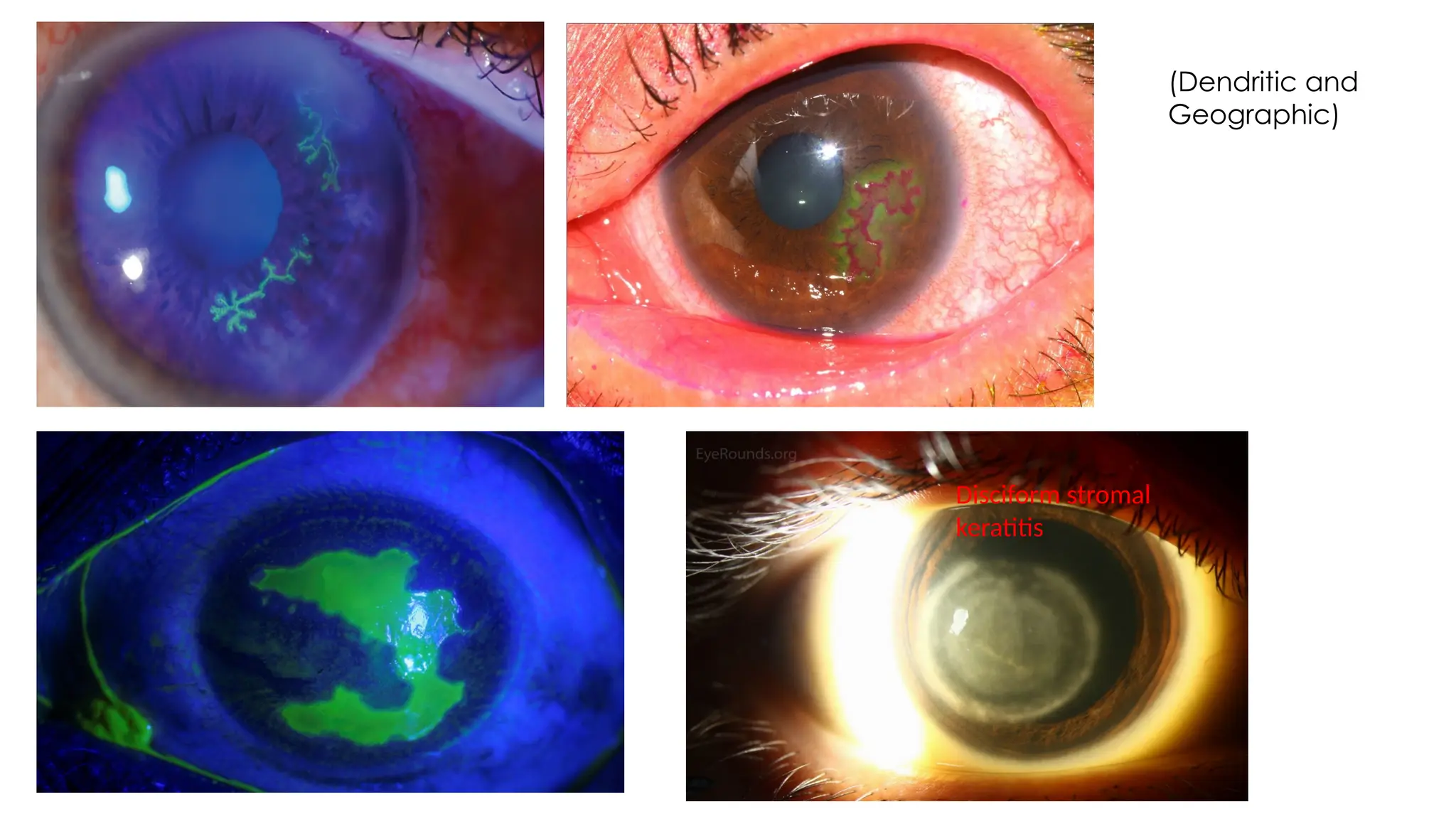 DISEASES OF THE CORNEA PH internal of the eye(1).pptx