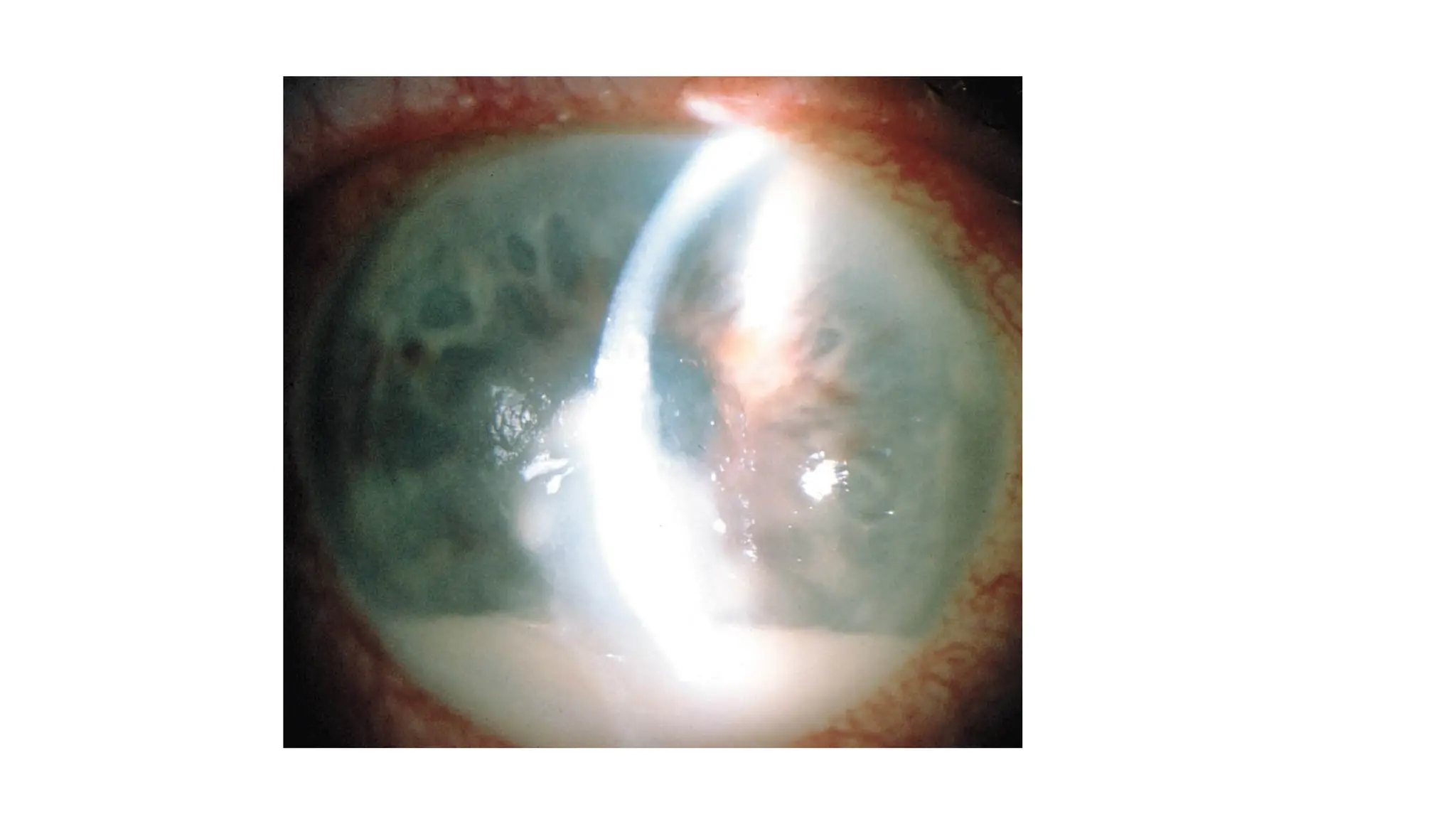 DISEASES OF THE CORNEA PH internal of the eye(1).pptx