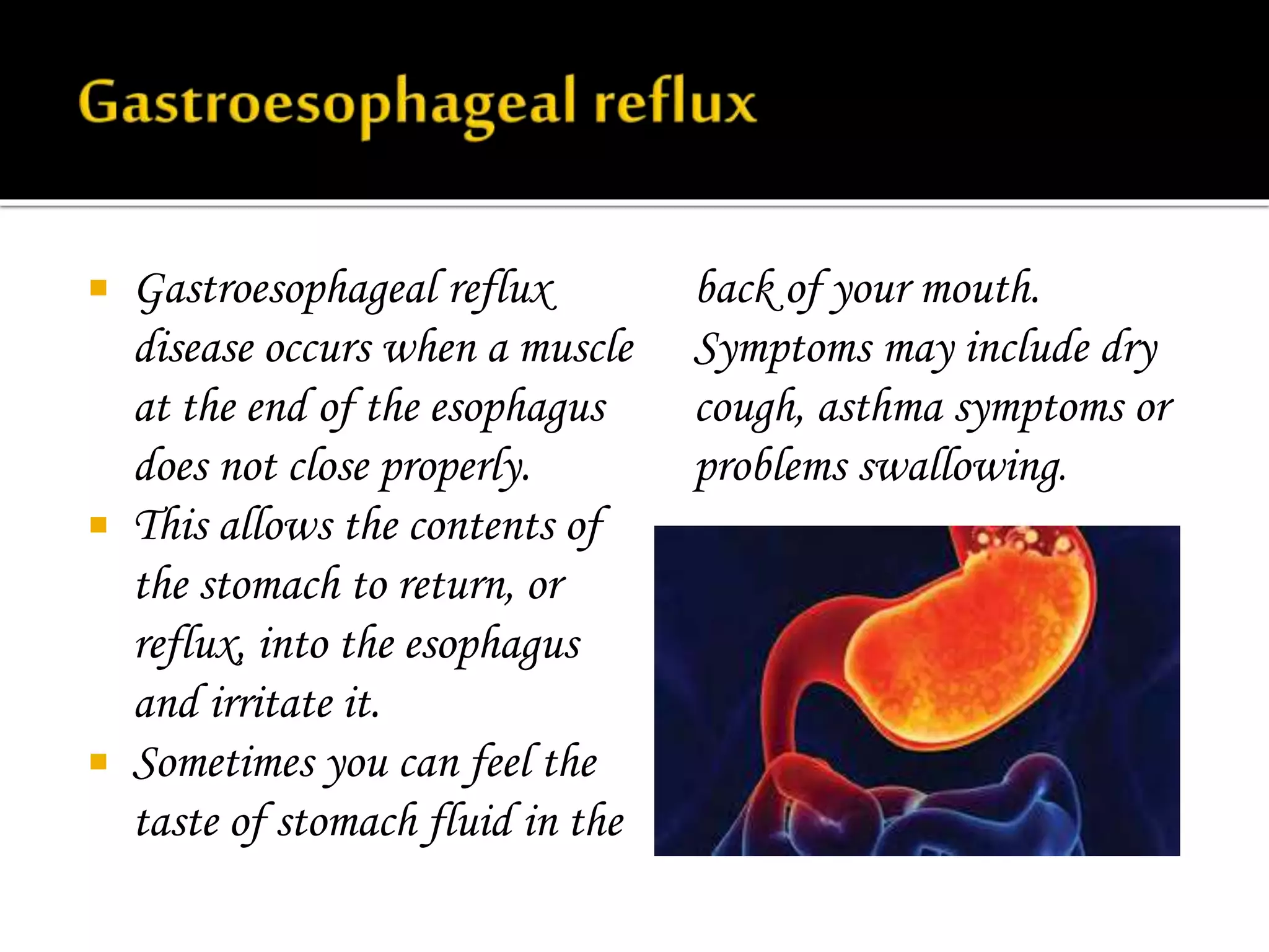 Diseases of the digestive system | PPTX
