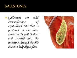 Diseases of the digestive system | PPTX