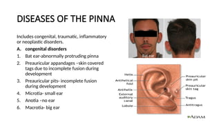 DISEASES OF THE EXTEhhhhhhhRNAL EAR-1.pptx