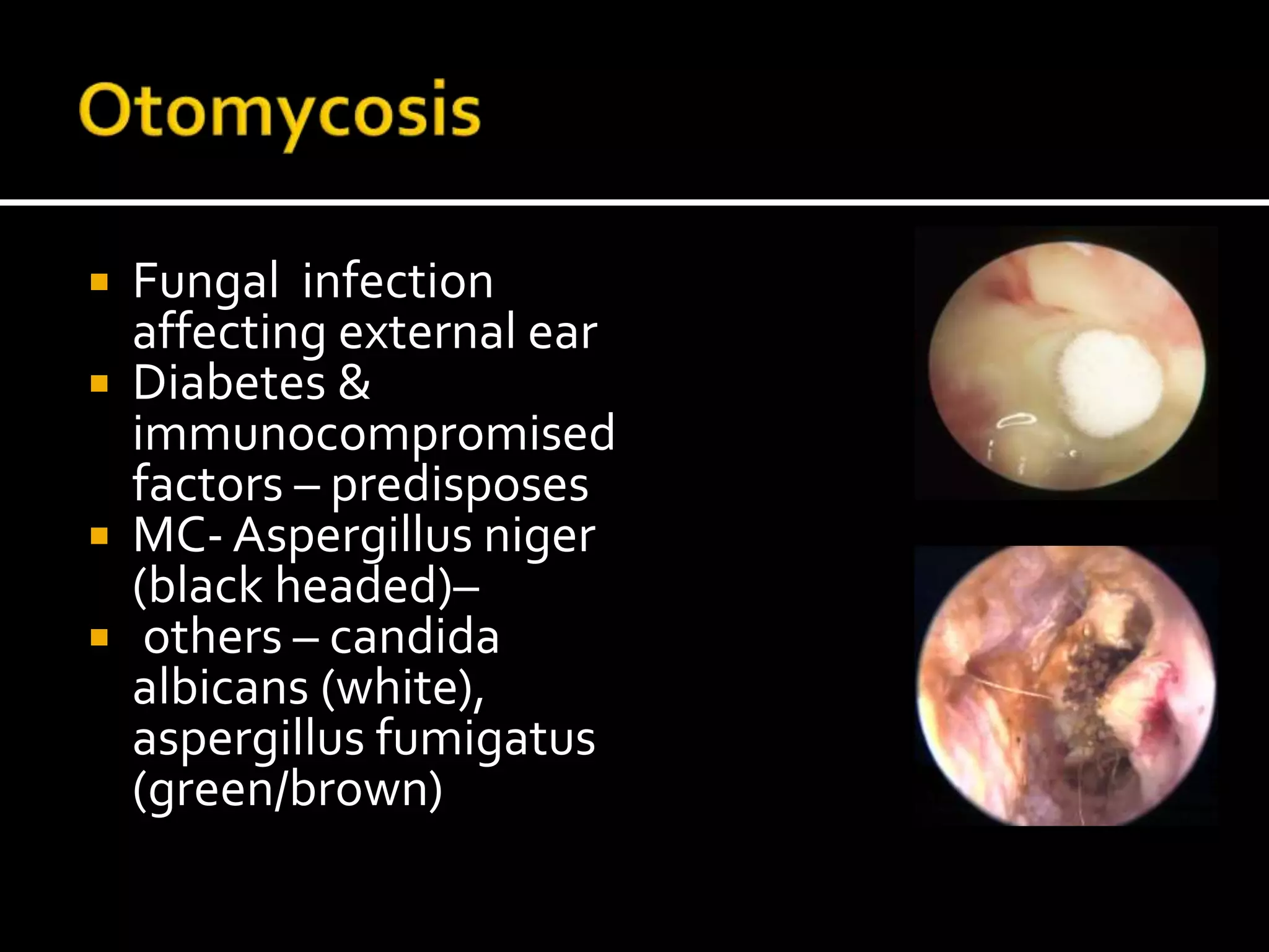 Diseases of the external ear | PPTX