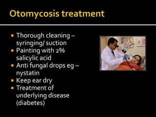 Diseases of the external ear | PPTX