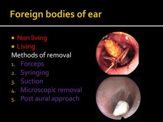 Diseases of the external ear | PPTX | Ear, Nose and Throat Conditions ...