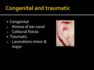 Diseases of the external ear | PPTX