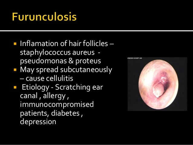Diseases of the external ear