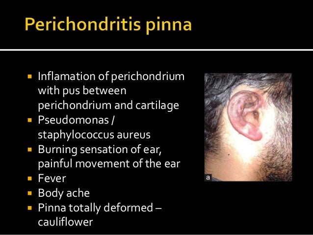 Diseases Of The External Ear