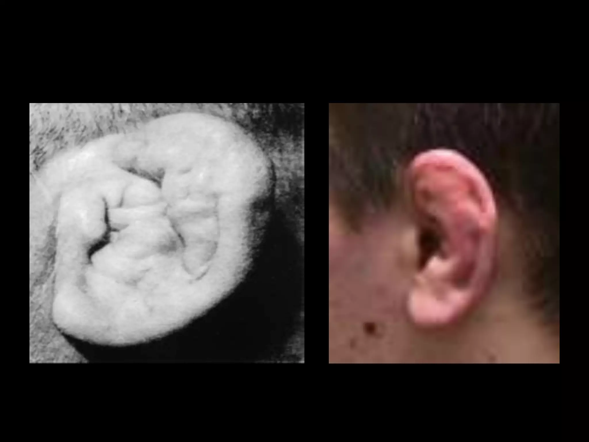 Diseases of the External Ear.ppt