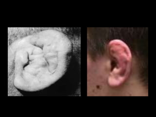 Diseases of the External Ear.ppt