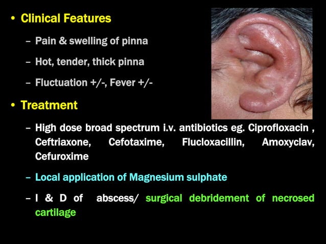 Diseases of the External Ear.ppt