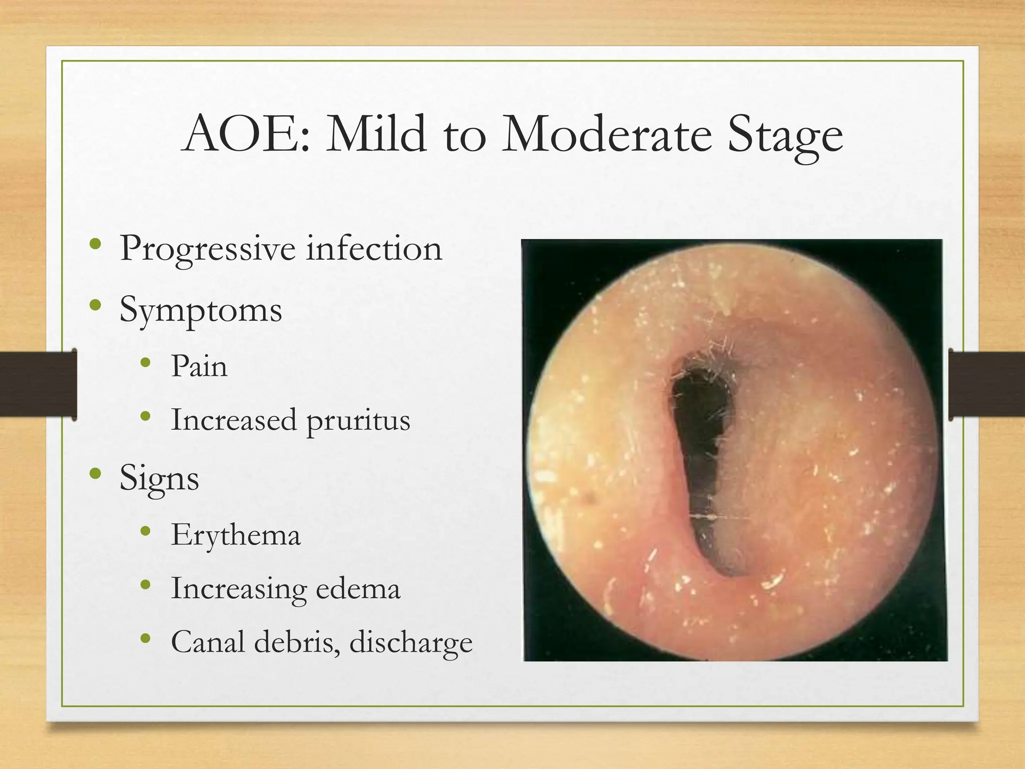 Diseases of the external ear and anatomy of the ear | PPT