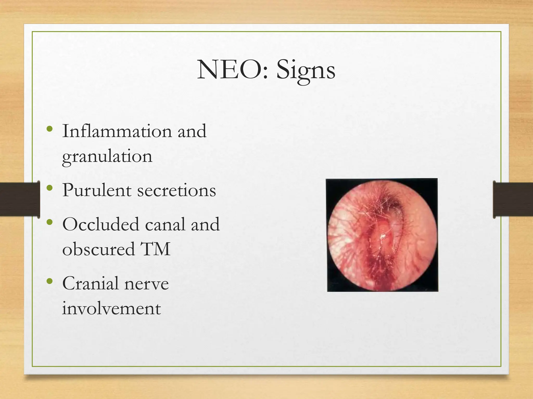 Diseases of the external ear and anatomy of the ear | PPT