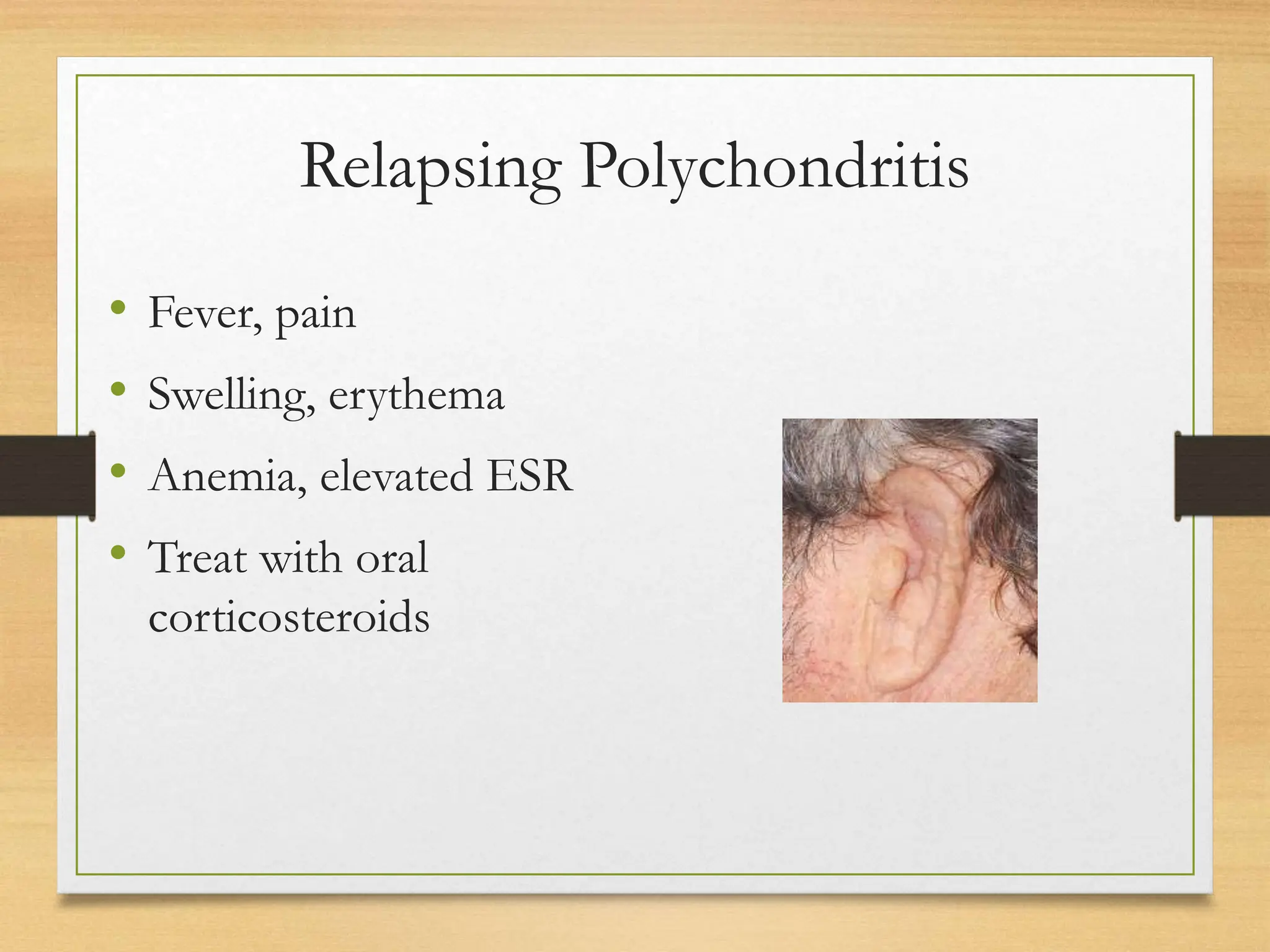 Diseases of the external ear and anatomy of the ear | PPT