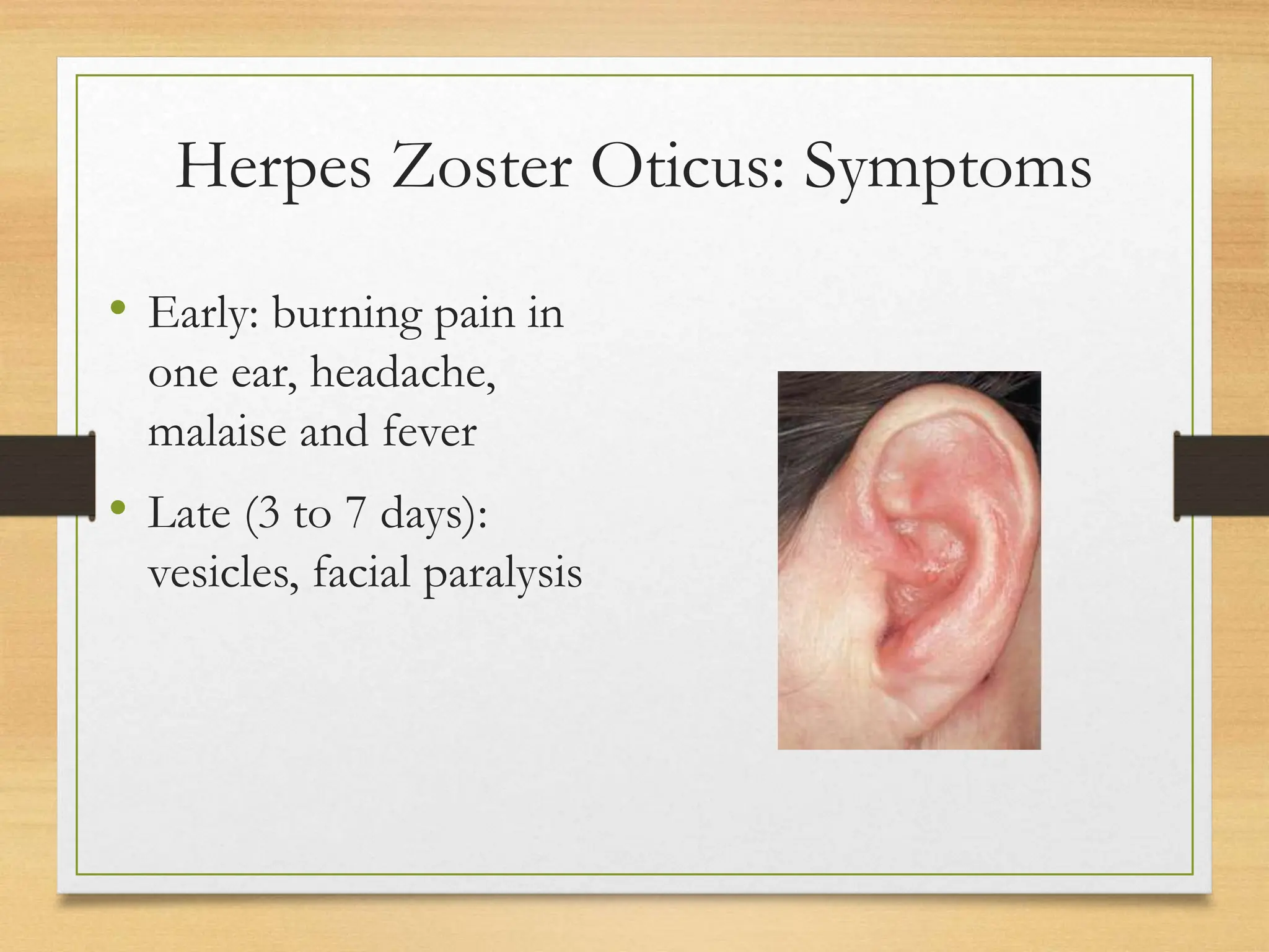 Diseases of the external ear and anatomy of the ear | PPT