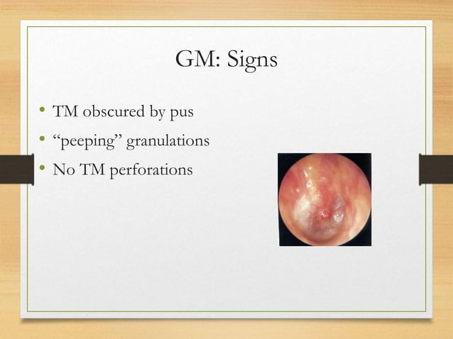 Diseases of the external ear and anatomy of the ear | PPT