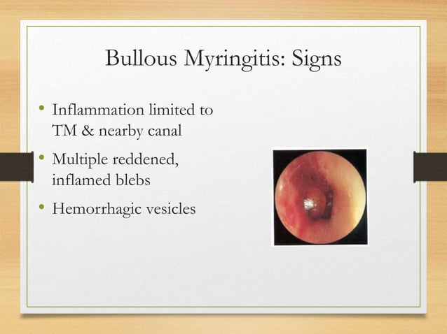 Diseases of the external ear and anatomy of the ear | PPT