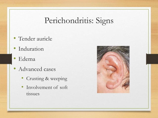 Diseases of the external ear and anatomy of the ear | PPT