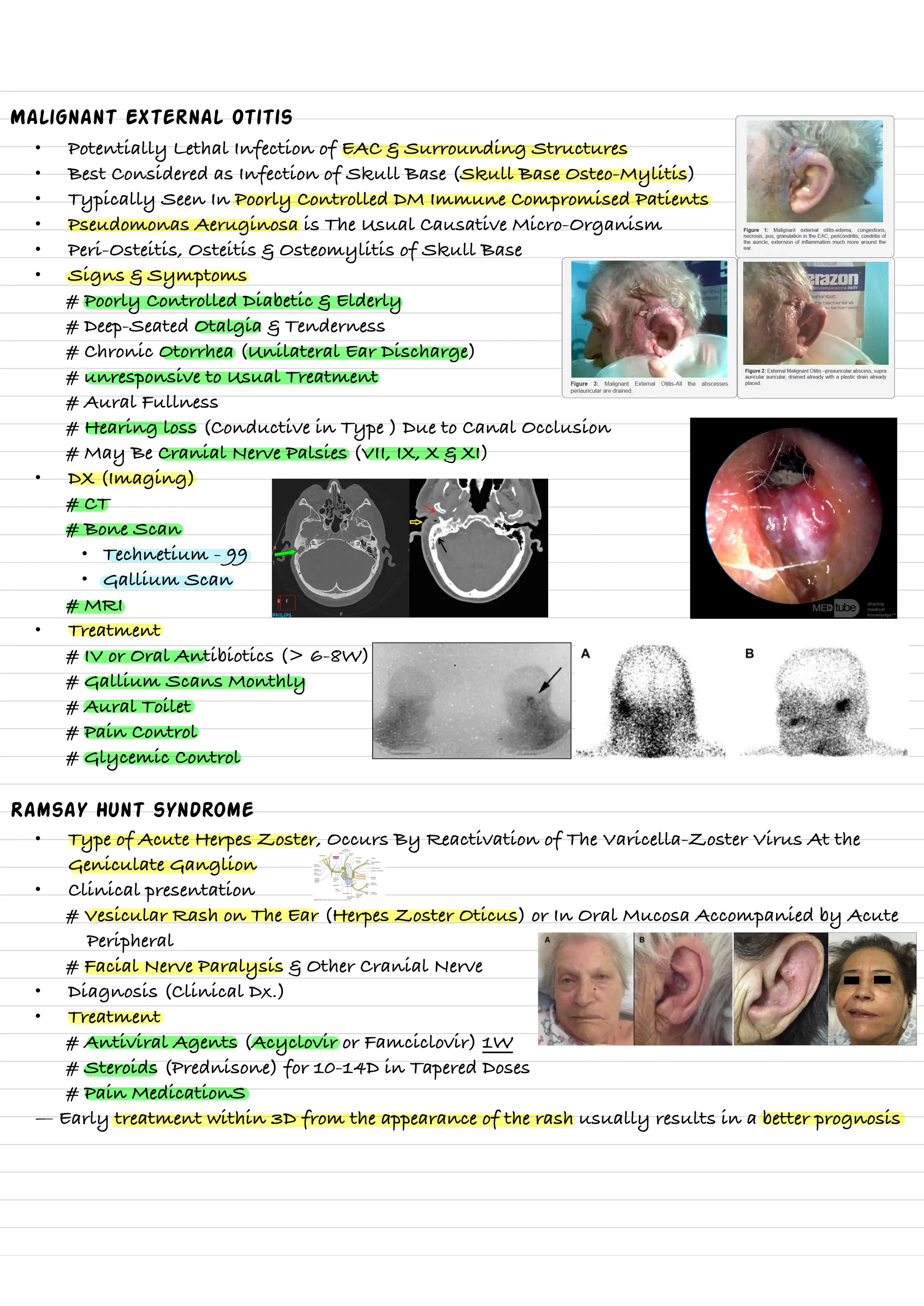 Diseases of The External Ear (special sens.).pdf