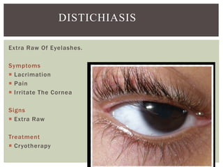 DISEASES OF THE EYELIDS.pptx
