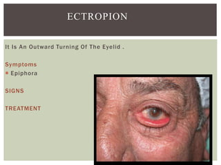 DISEASES OF THE EYELIDS.pptx