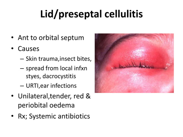 DISEASES OF THE EYE LIDS -JKUAT(1).pptx | Ear, Nose and Throat ...