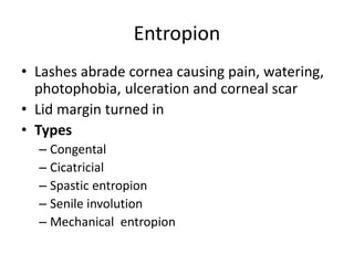 DISEASES OF THE EYE LIDS -JKUAT(1).pptx