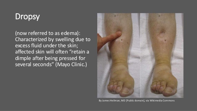 Diseases of the famine