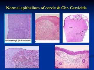 Diseases of the female genital tract | PPTX