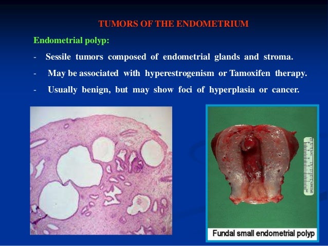 Diseases of the female genital tract
