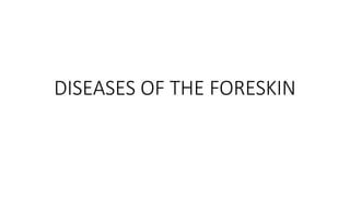 DISEASES OF THE FORESKIN and their management | PPTX